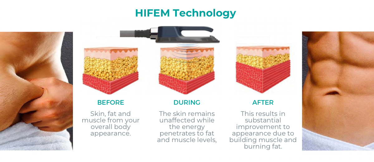 ‘Musculpter’ Muscle Building and Fat Burning Machine - Skin Tech